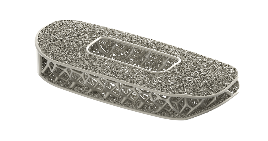 NuVasive exploite l'écosystème de la fabrication additive pour ...